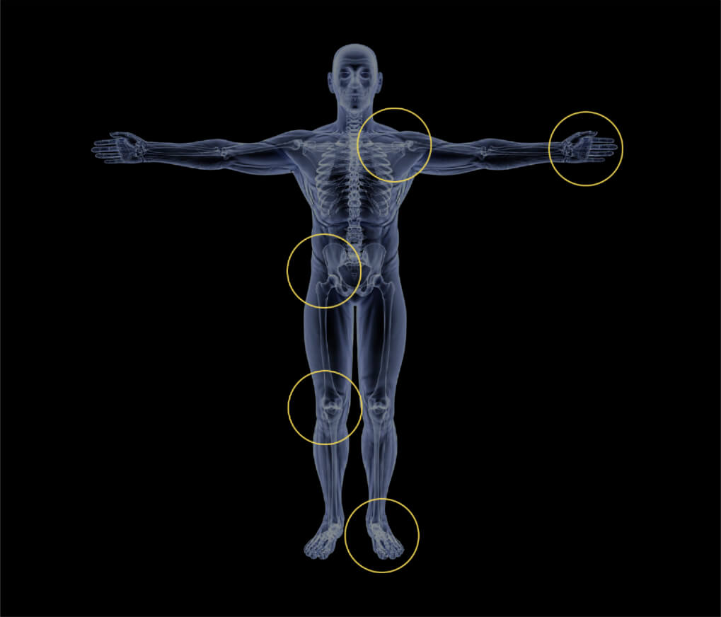 Joint Replacement Baltimore, Maryland | Towson Orthopaedics